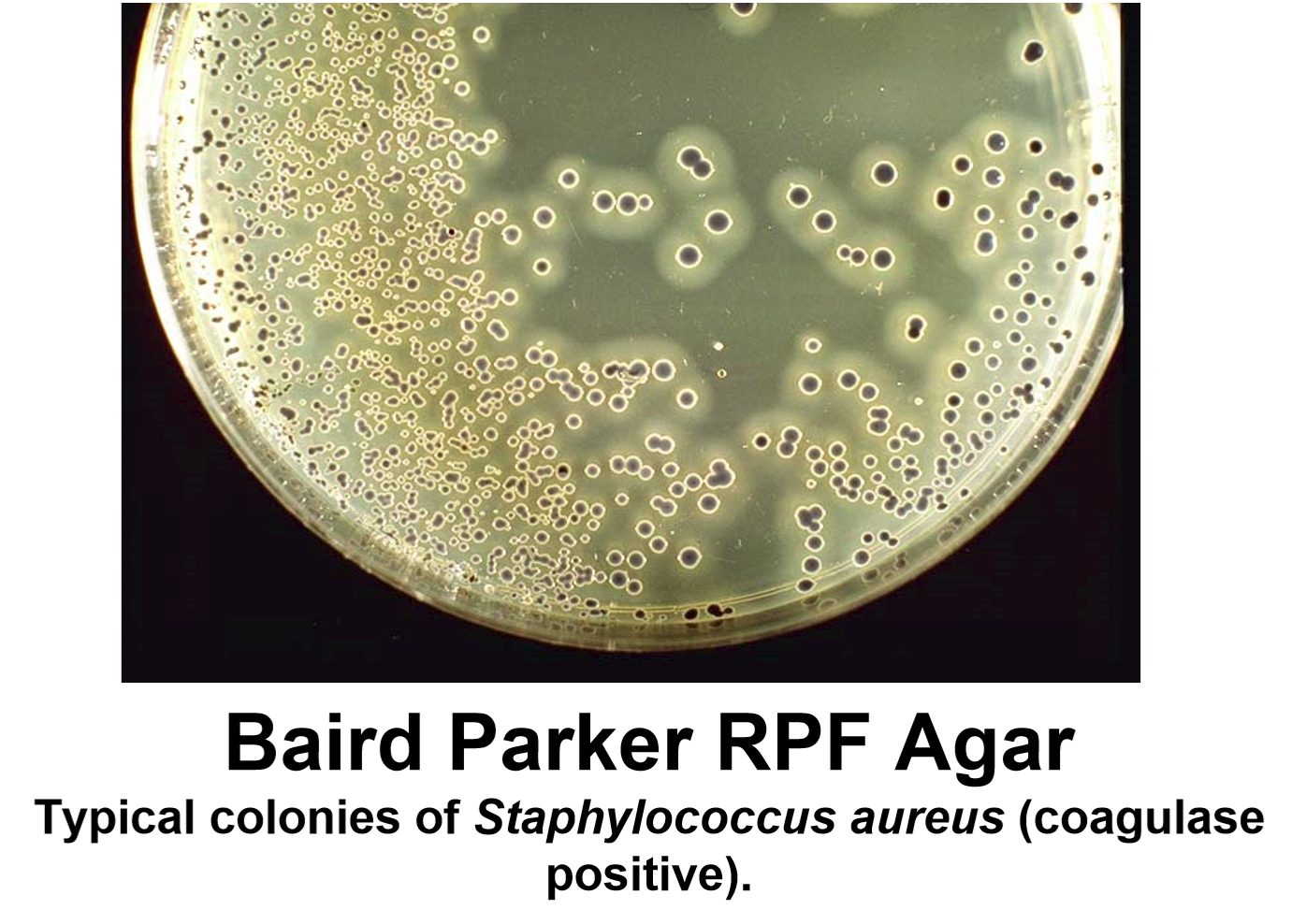 Colonias de Staphylocuccus creciendo en medio Baird Parker